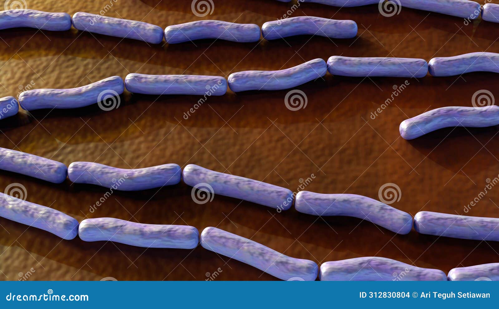 Anthrax Is A Disease Caused By The Bacillus Anthracis Royalty-Free ...