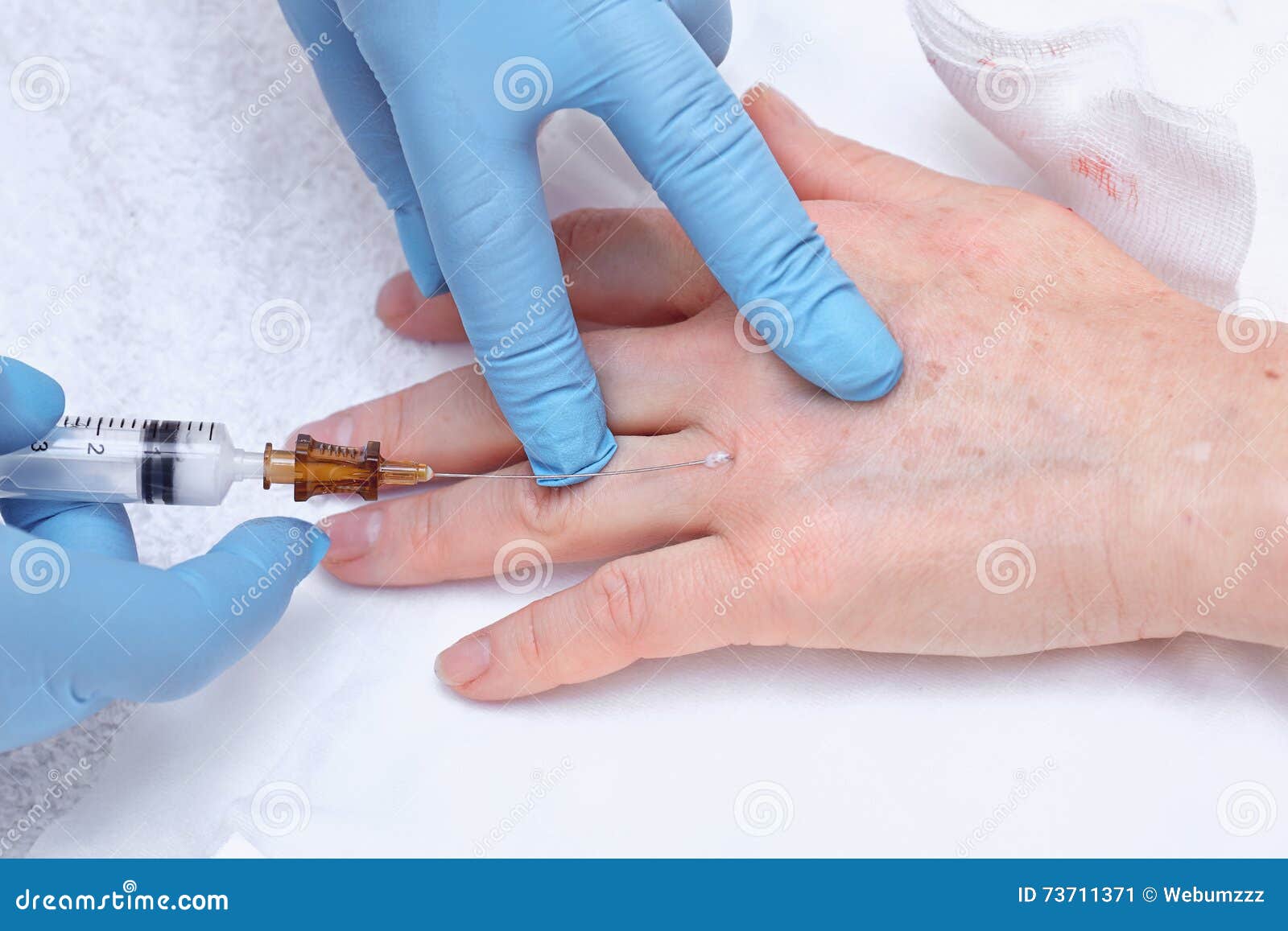 Anti-age Injection Therapy. Hand Rejuvenation. Stock Image - Image of ...