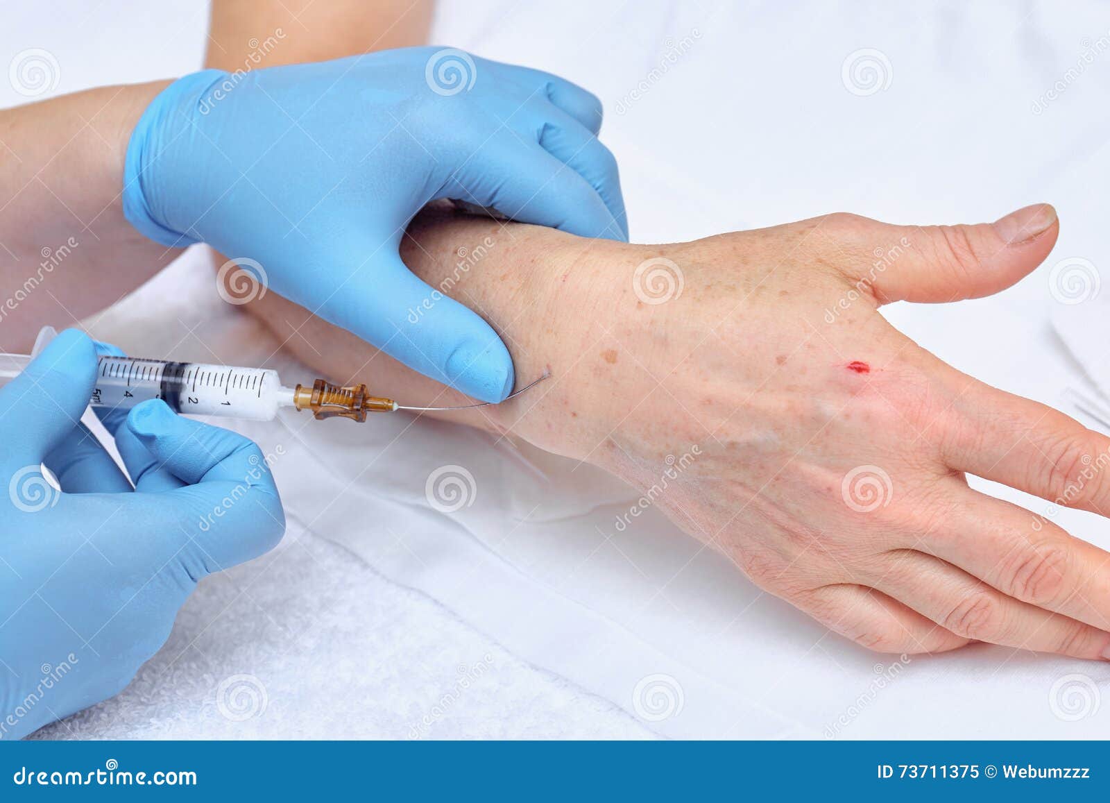 Anti-age Injection Therapy. Hand Rejuvenation. Stock Image - Image of ...