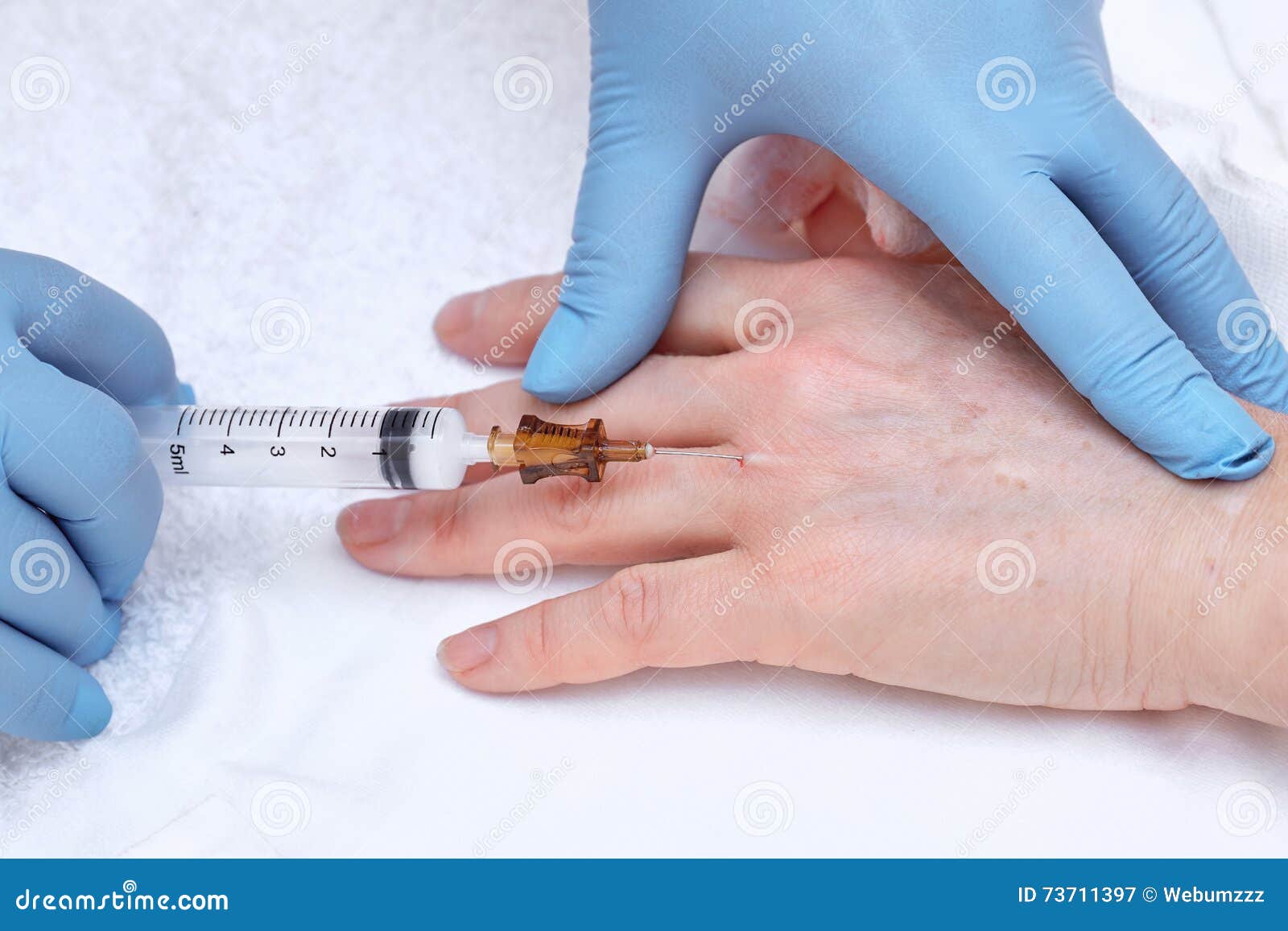 Anti-age Injection Therapy. Hand Rejuvenation. Stock Image - Image of ...