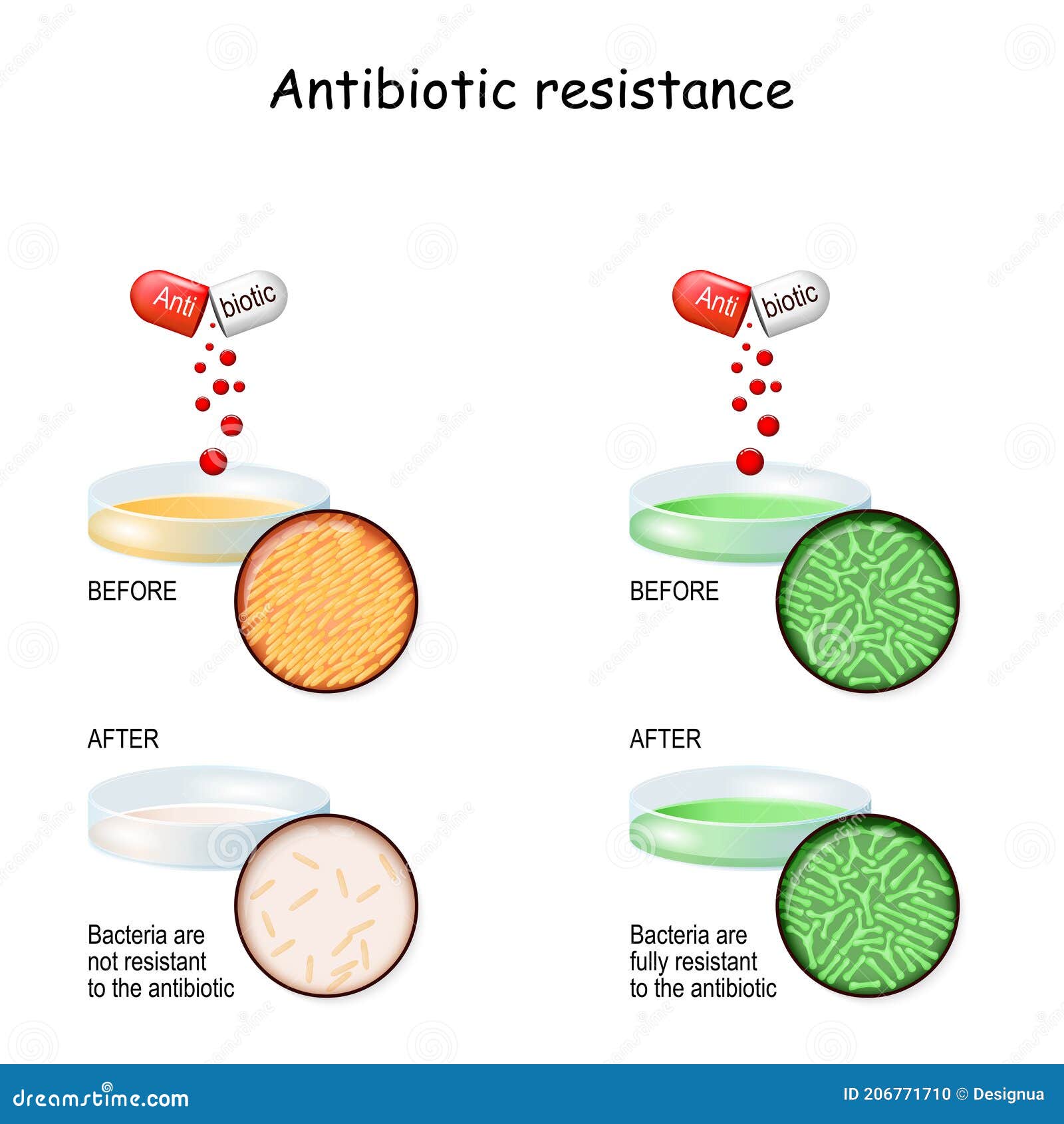 Antibiotic Resistance Outline Diagram, Illustrated Mechanism In ... Antibiotic Resistance Outline Diagram, Illustrated Mechanism In ...