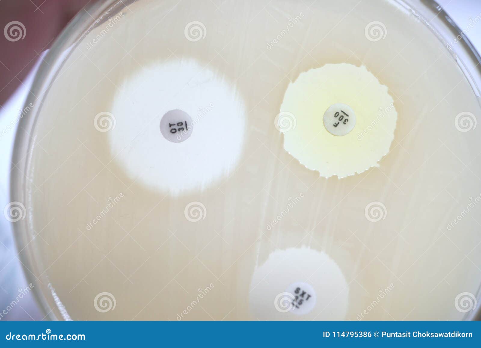 Antibiotic Sensitivity of Bacteria by Means of Diffusion Test is Stock ...