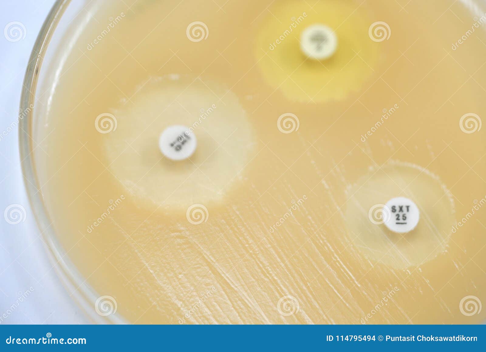 Antibiotic Sensitivity of Bacteria by Means of Diffusion Test is Stock ... Antibiotic Sensitivity of Bacteria by Means of Diffusion Test is Stock ...