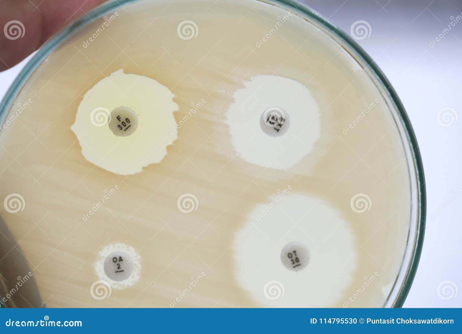 Antibiotic Sensitivity of Bacteria by Means of Diffusion Test is Stock ...