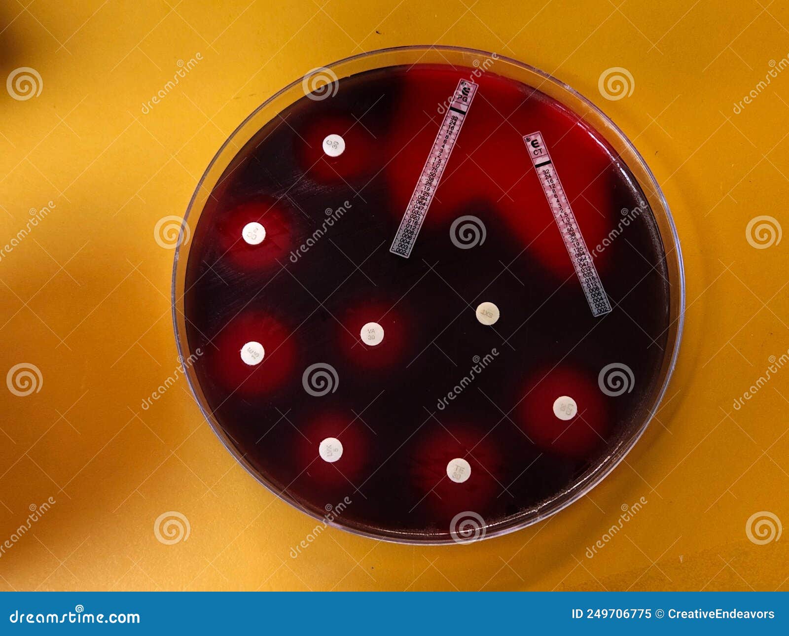Antibiotic Susceptibility Testing - Agar Plate with Discs and E-Test ...