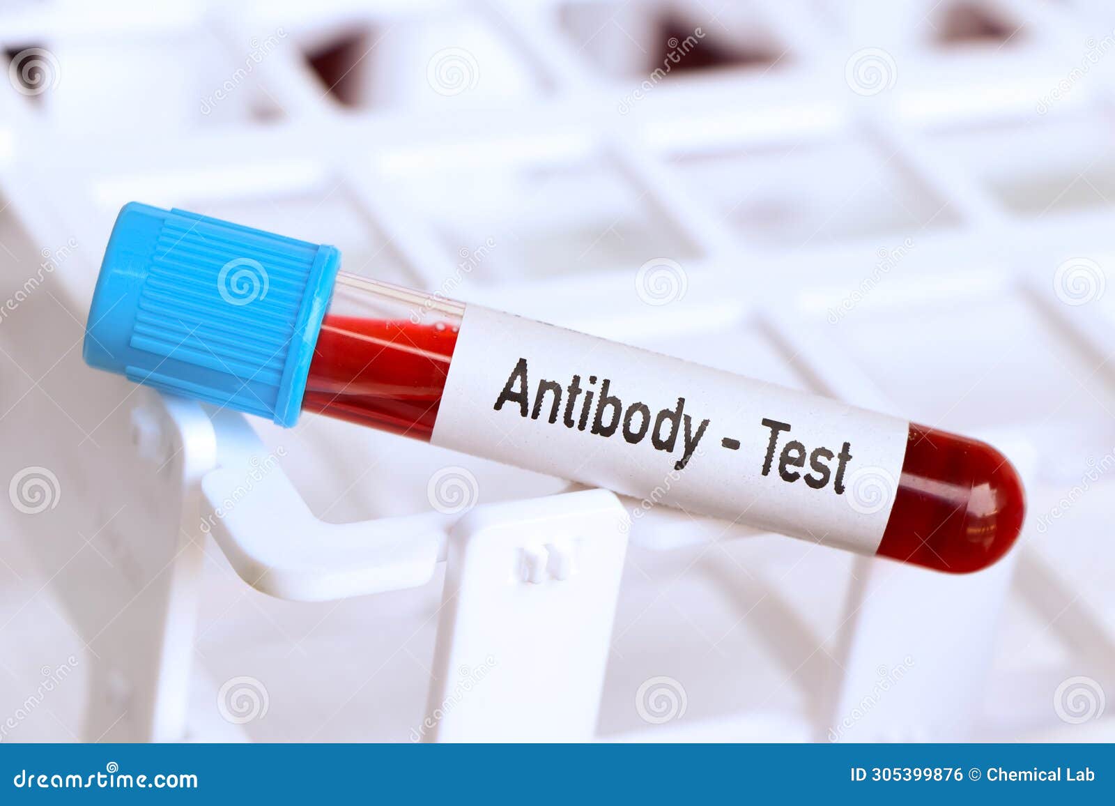 Antibody Test, Blood Sample To Analyze in the Laboratory Stock Photo ...