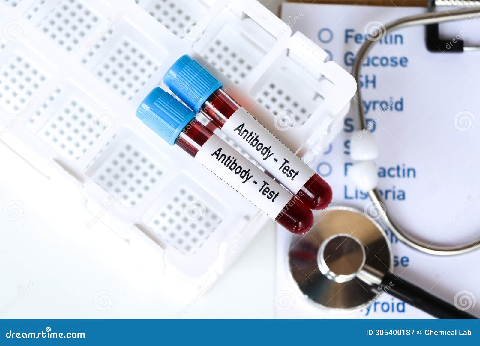 Antibody Test, Blood Sample To Analyze in the Laboratory Stock Image ...