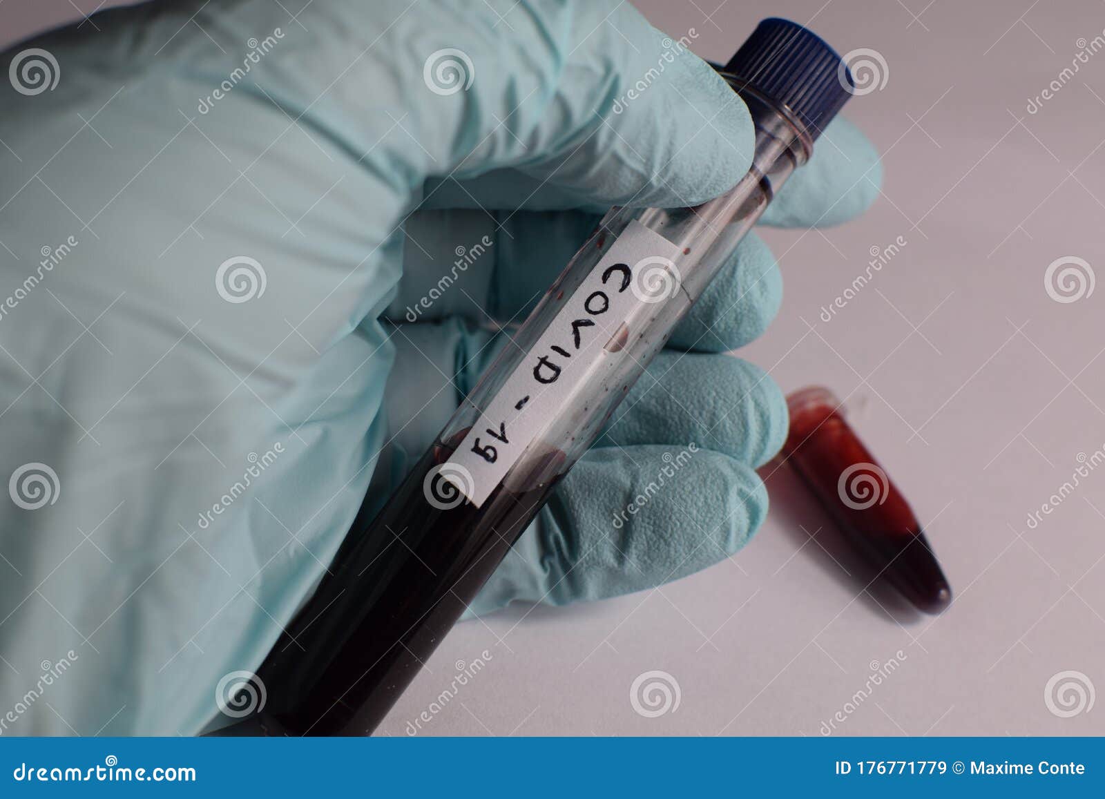 Antibody test covid19 stock image. Image of vaccin, pandemic - 176771779