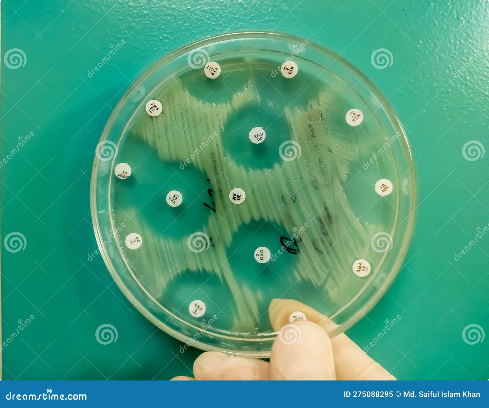 Antimicrobial Susceptibility Testing in Culture Plate. Drug Sensitivity ... Antimicrobial Susceptibility Testing in Culture Plate. Drug Sensitivity ...