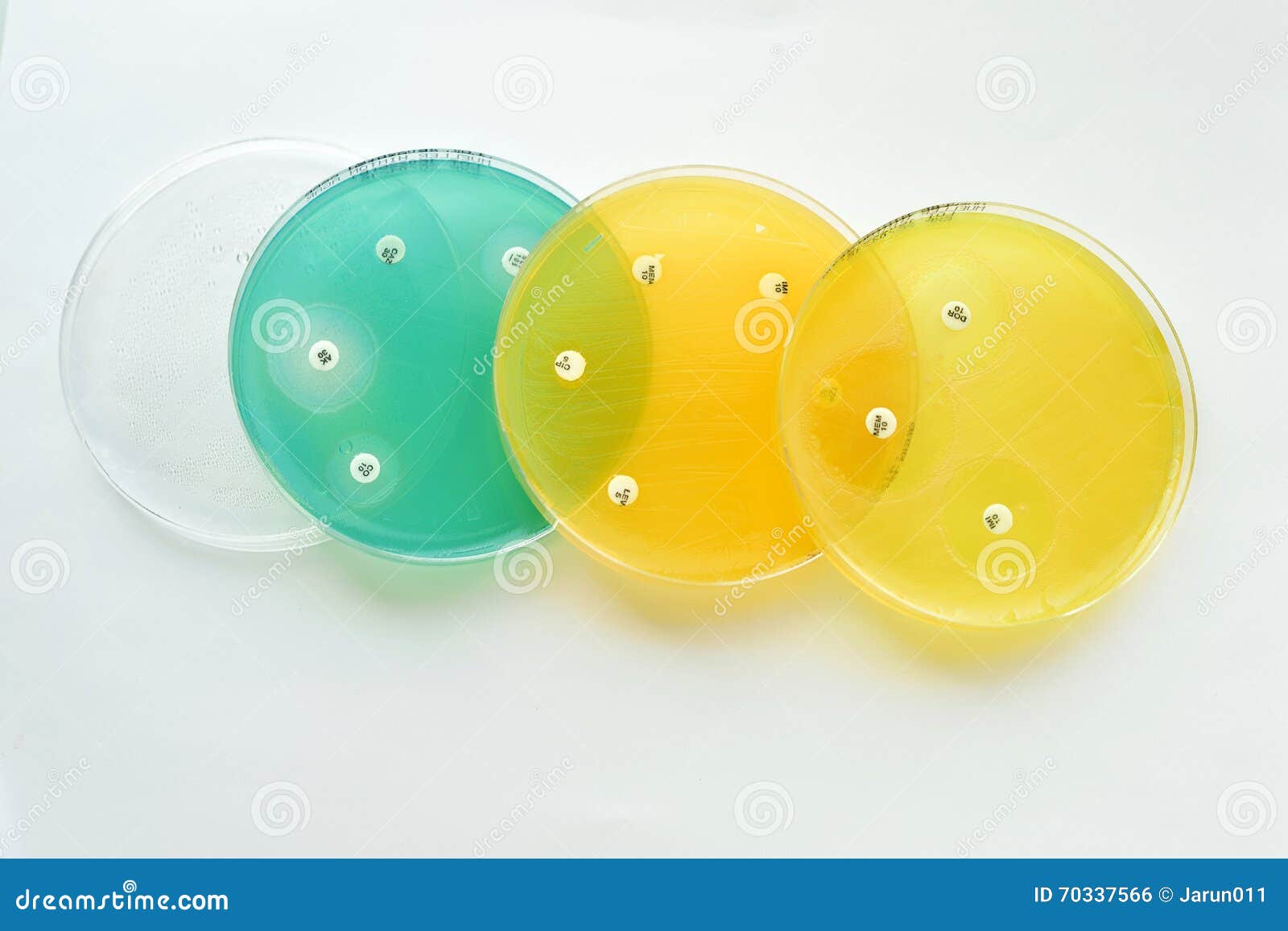 Antimicrobial Susceptibility Testing Stock Photo - Image of biology ... Antimicrobial Susceptibility Testing Stock Photo - Image of biology ...