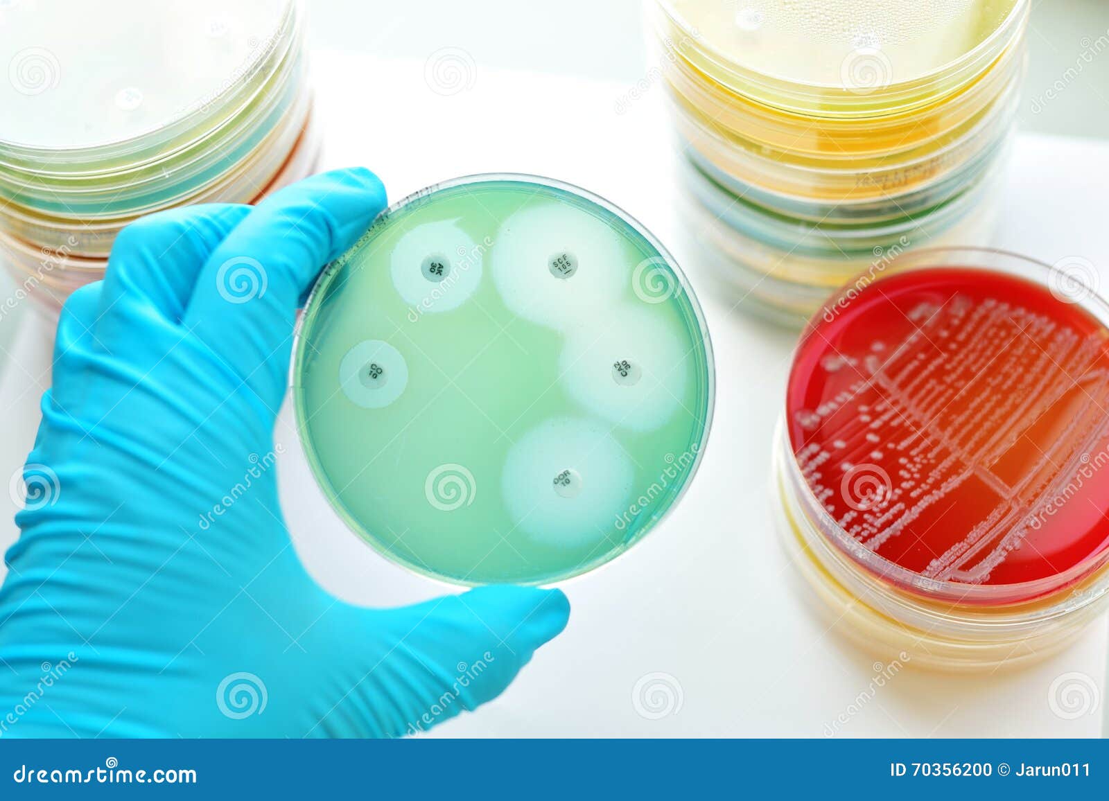 Antimicrobial Susceptibility Testing Stock Photo - Image of antibiotic ... Antimicrobial Susceptibility Testing Stock Photo - Image of antibiotic ...