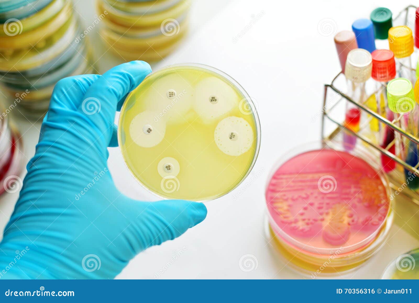 Antimicrobial Susceptibility Testing Stock Photo - Image of colonies ...