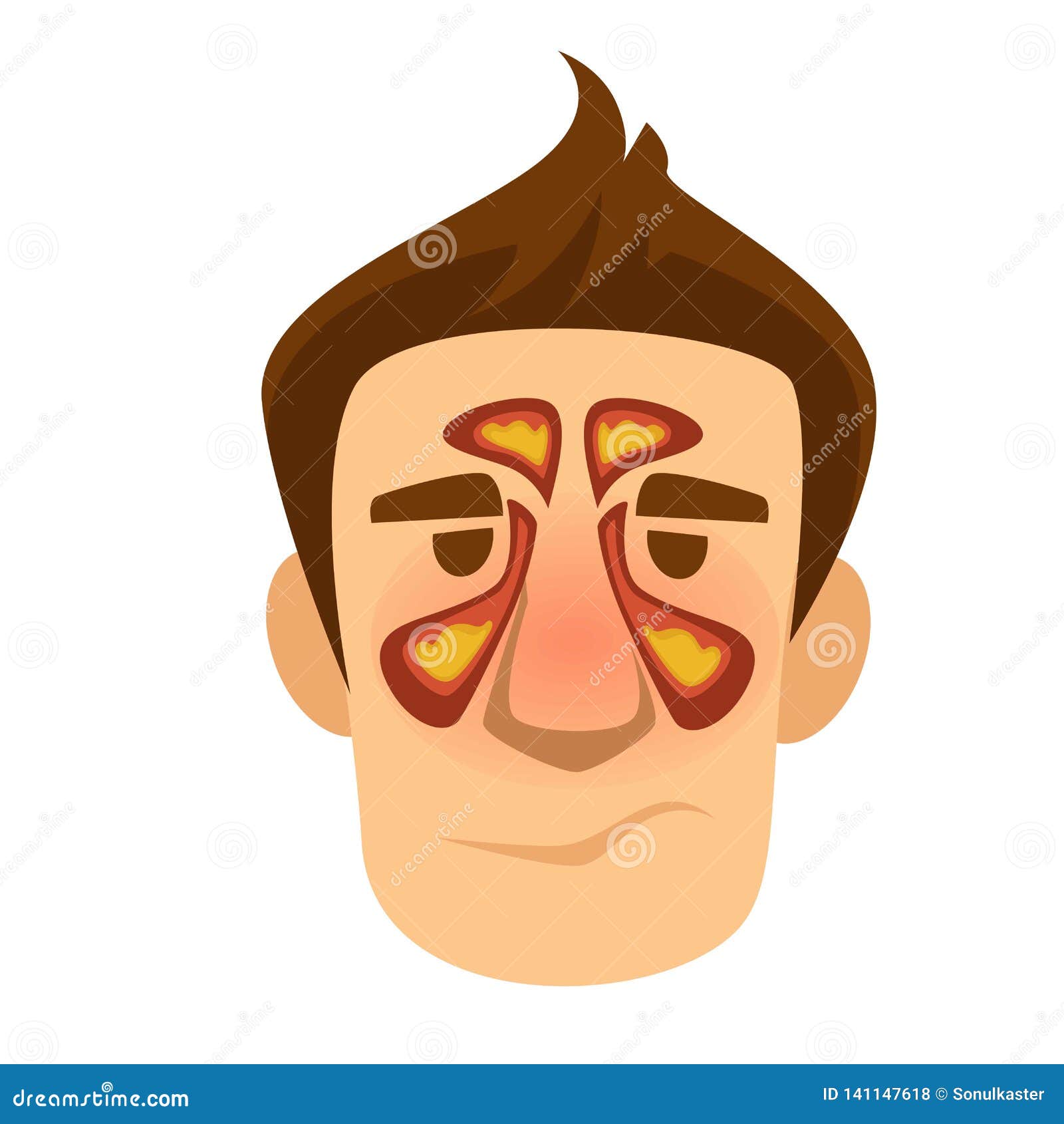 Antritis And Respiratory Sinuses Inflammation Isolated Male Head Stock