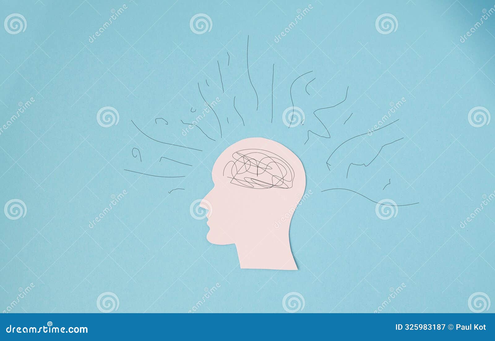 Anxiety Stress in Brain, Overload in Mind. Depression, Adhd, Ocd Stock ...