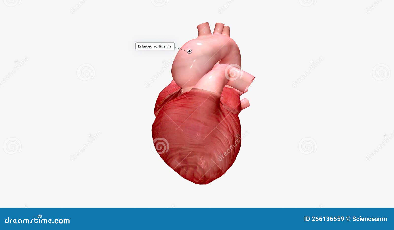 The Aortic Arch Connects the Ascending Aorta To the Descending Aorta ...