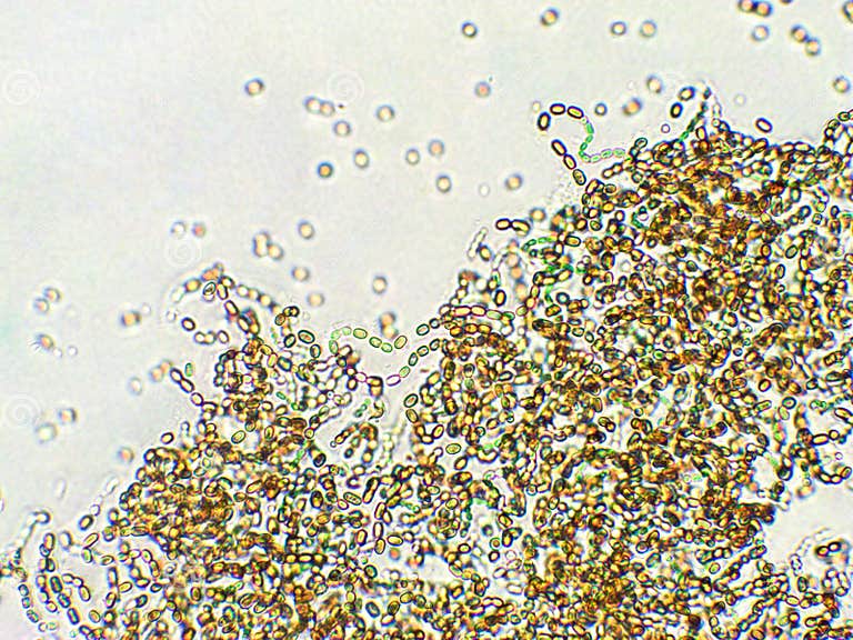 Aphanothece Sp. Algae Under Microscopic View Stock Image - Image of ...