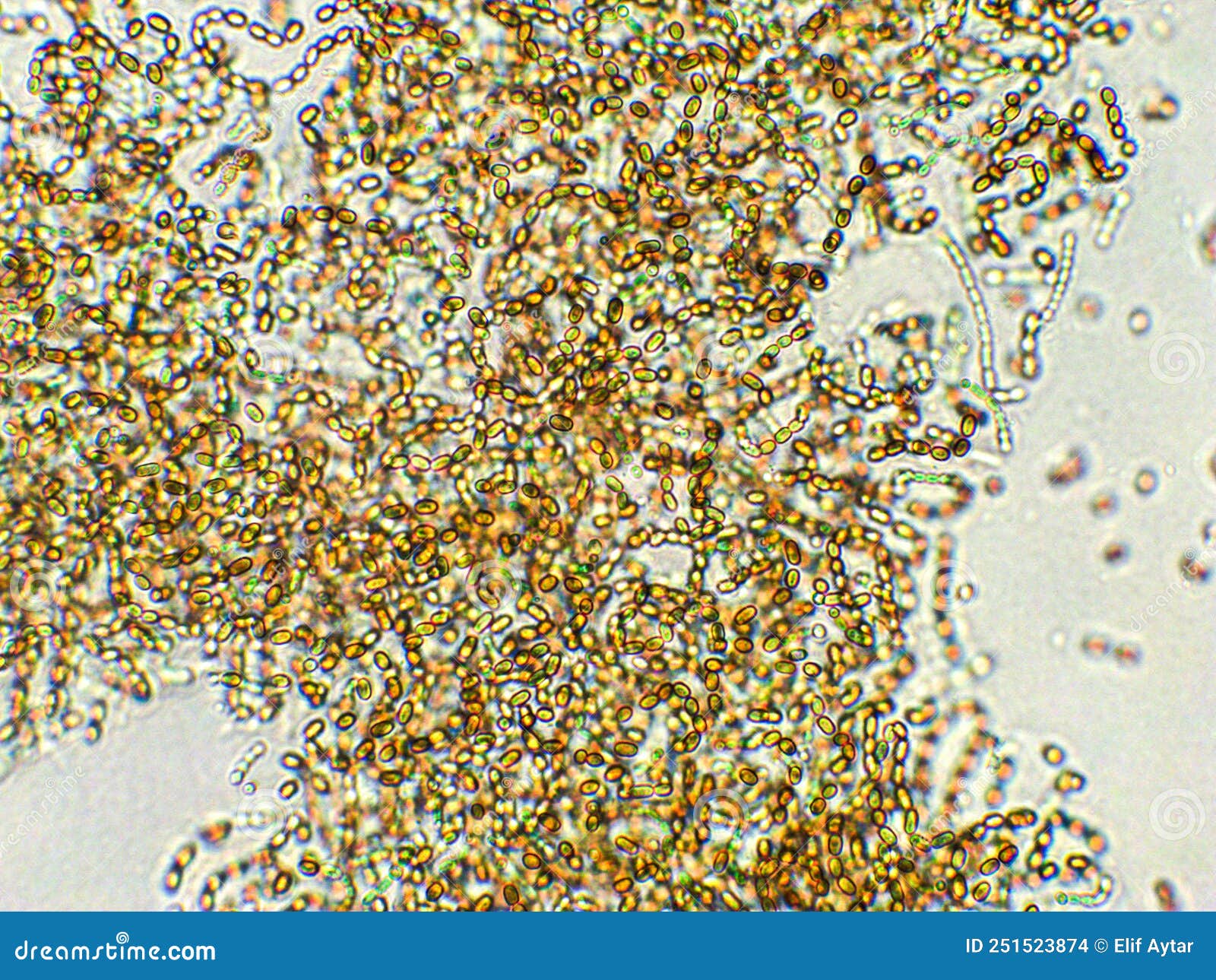 Aphanothece Sp. Algae Under Microscopic View, Cyanobacteria Stock Photo ...