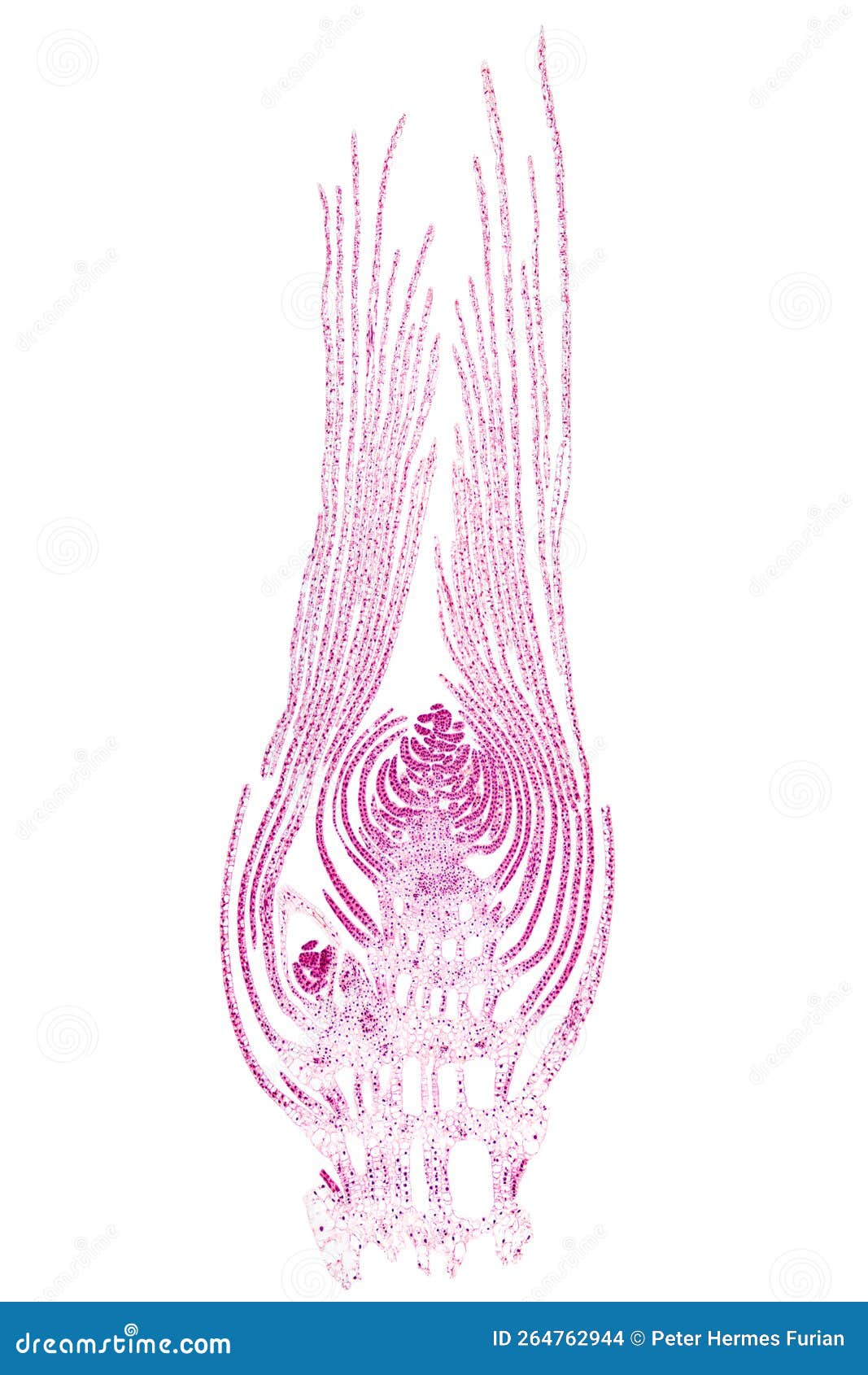 Apical Area Cytology