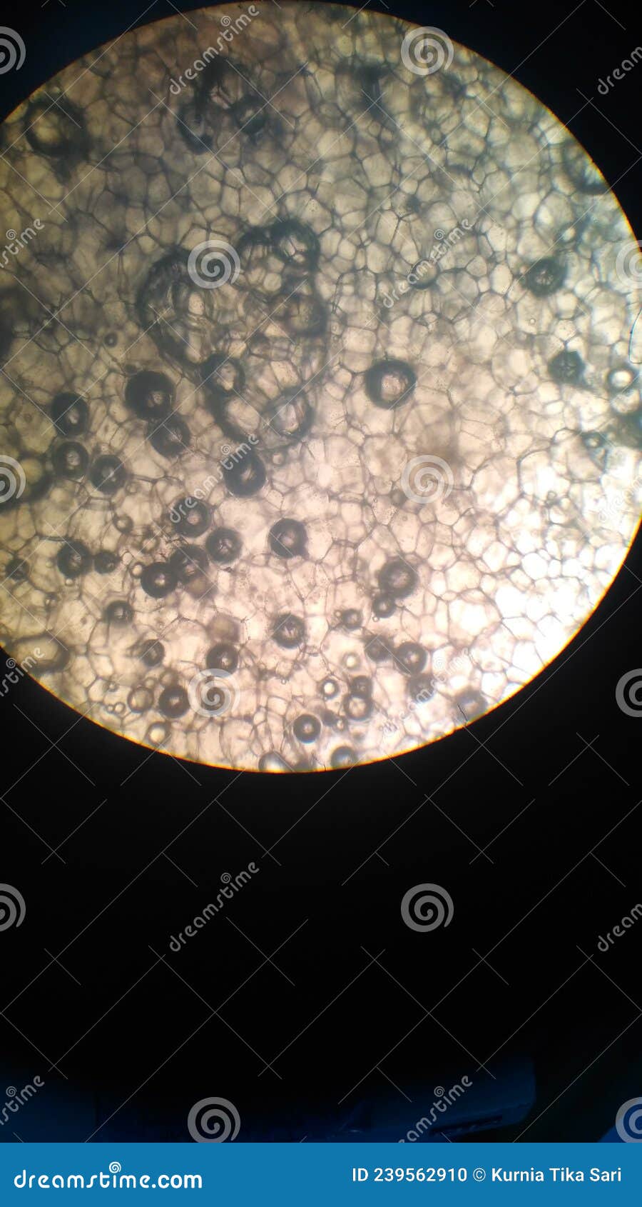 The Appearance of Aromatic Ginger Under the Microscope Stock Photo ...