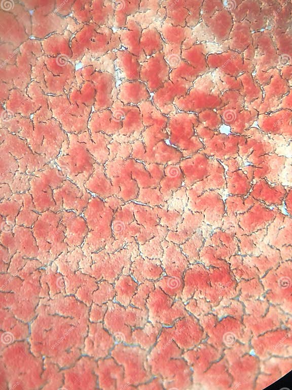 Appearance of Blood Haemin Crystals Under a Microscope Stock Image ...