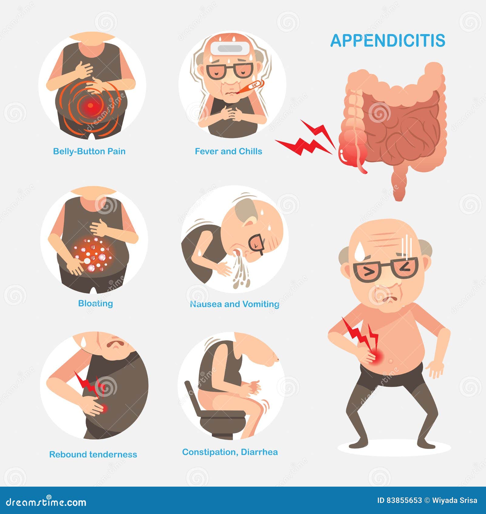 Appendicite illustration de vecteur. Illustration du abdominal - 83855653