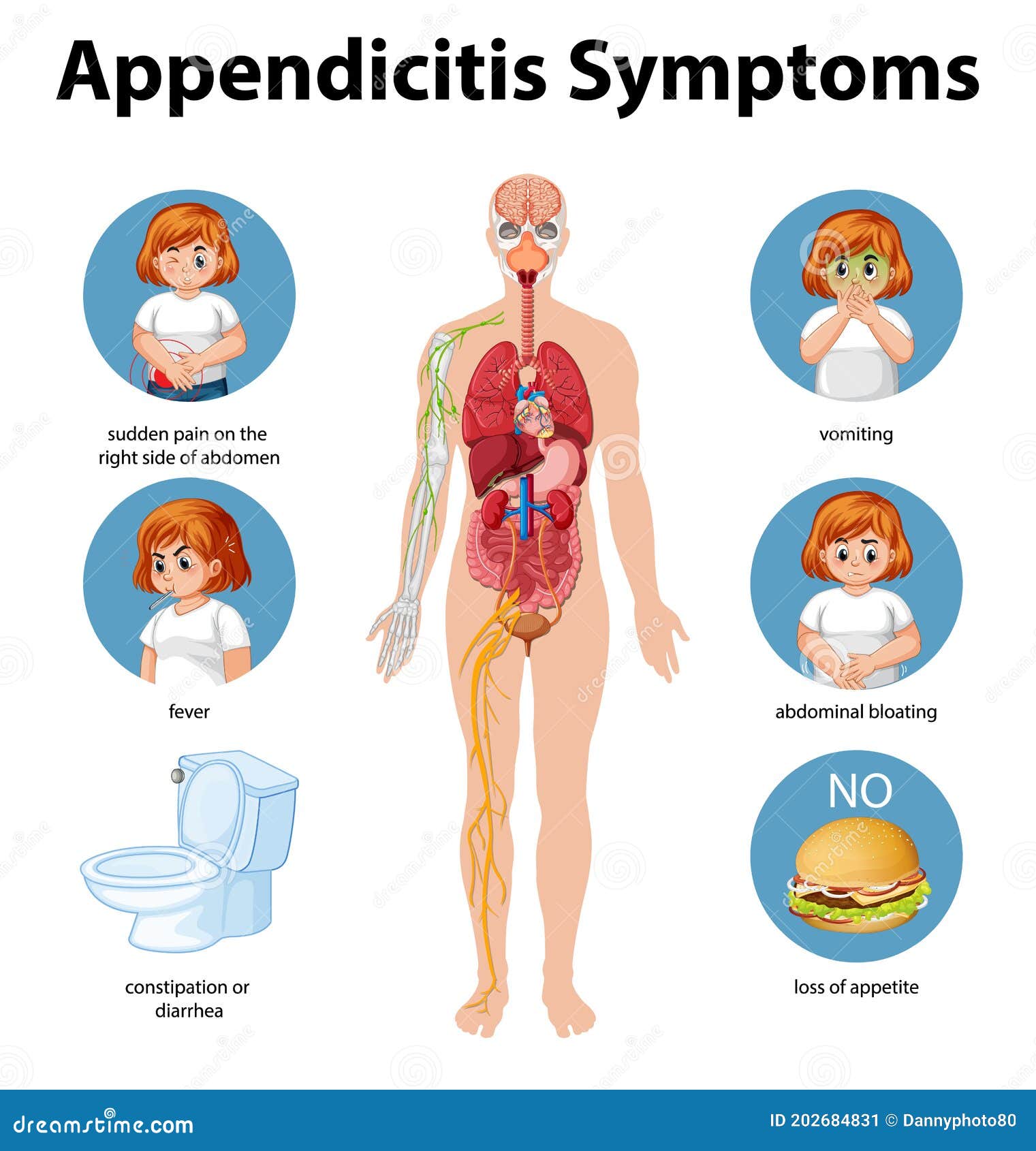 Appendicitis Symptoms Information Infographic Stock Vector