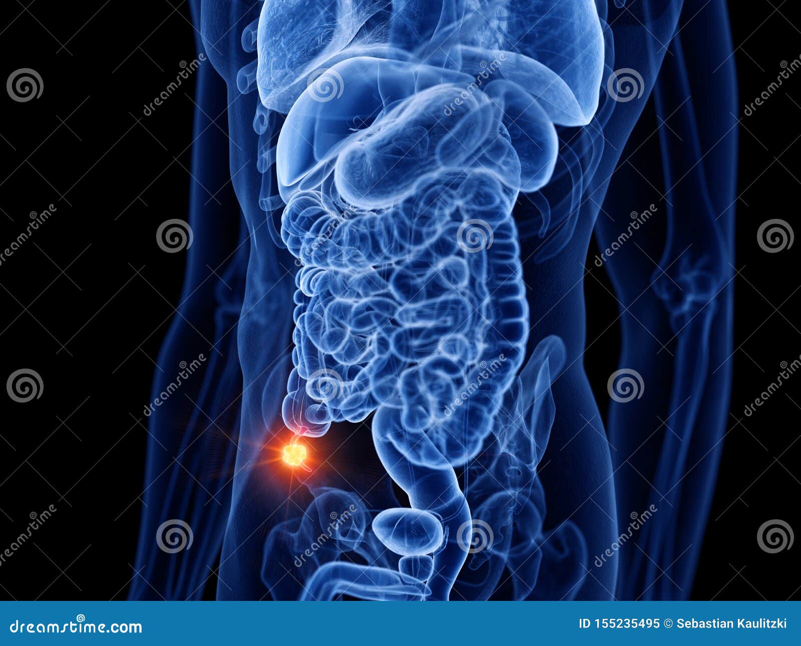 Appendix Cancer Awareness Ribbon Vector Illustration Isolated On White ...