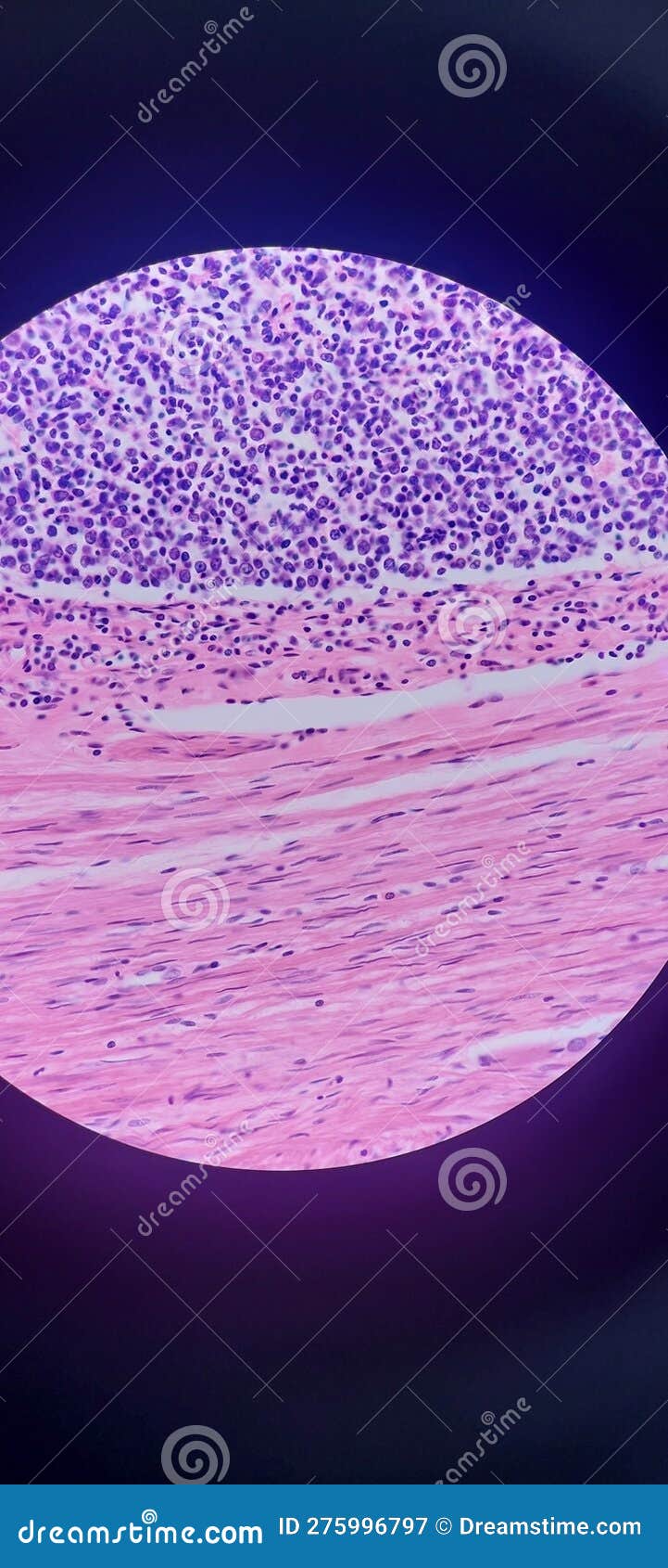 Appendix Histology Microscope Learn More about Tissues Stock Image ...