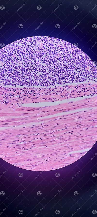 Appendix Histology Microscope Learn More about Tissues Stock Image ...