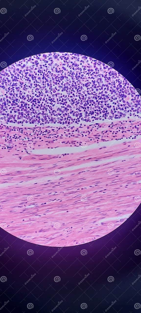 Appendix Histology Microscope Learn More about Tissues Stock Image ...