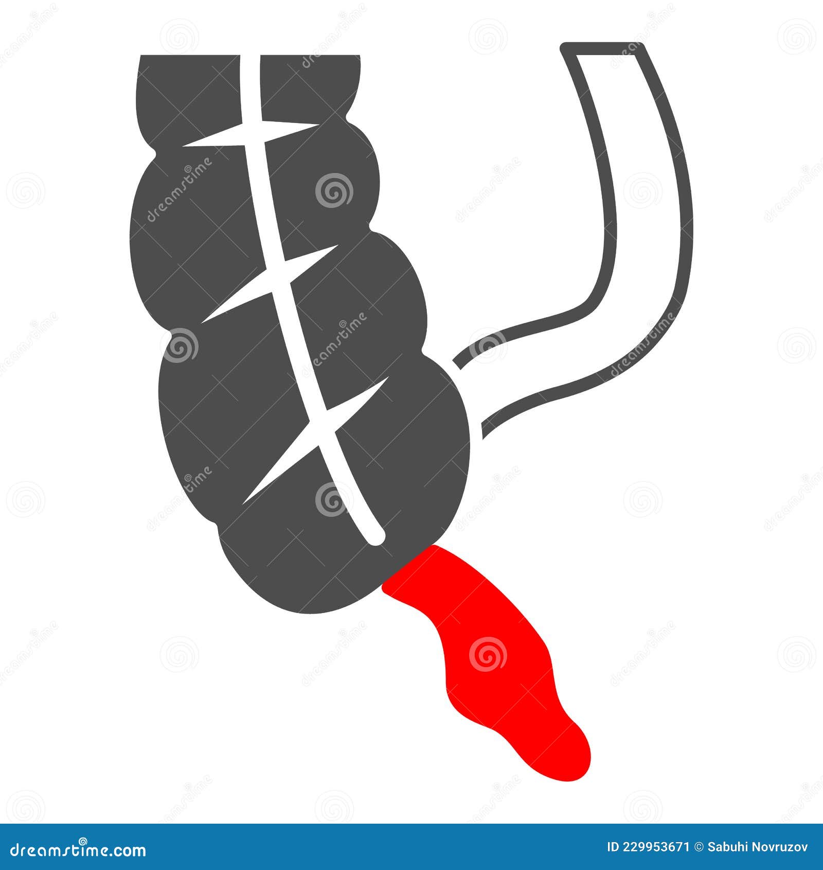 Appendicitis Inflamed Appendix Labeled Chart Cartoon Vector
