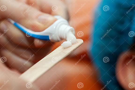 Application of Topical Anesthesia Cream Prior To a Dermatological ... Application of Topical Anesthesia Cream Prior To a Dermatological ...