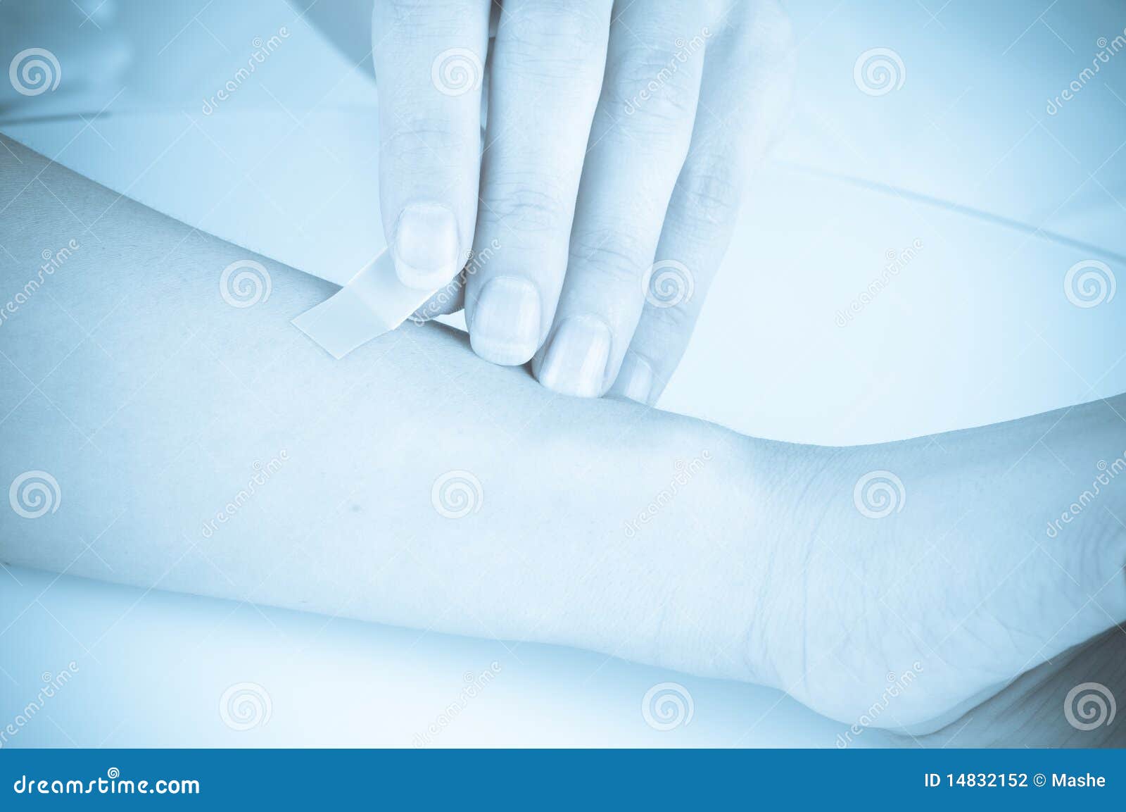 Applying plaster on arm stock photo. Image of medical - 14832152