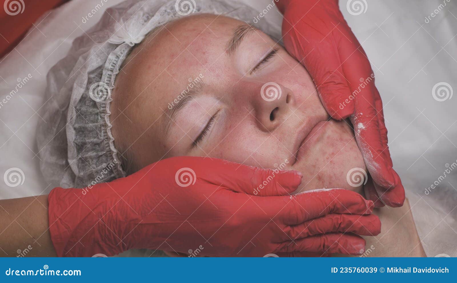 Applying Powder To The Clientand X27 S Face And Massage The Clientand X27 S