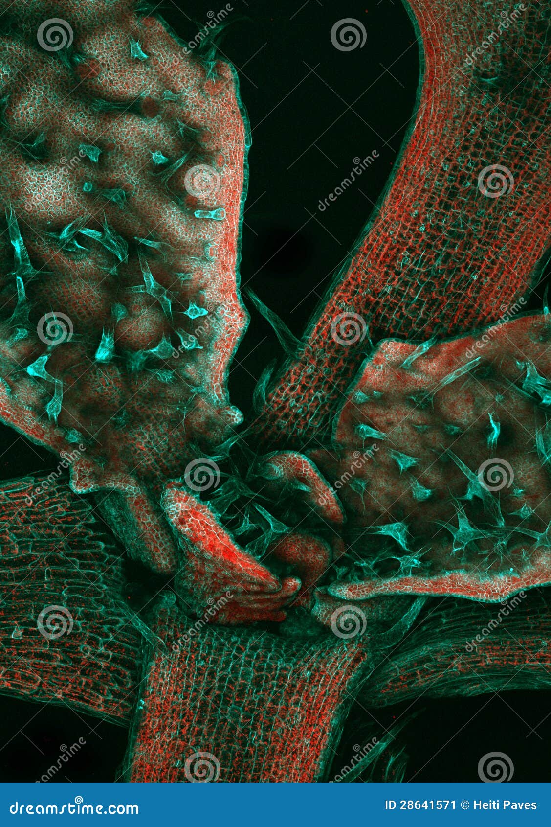 Arabidopsis Leaves And Trichomes Stock Image | CartoonDealer.com #28641571