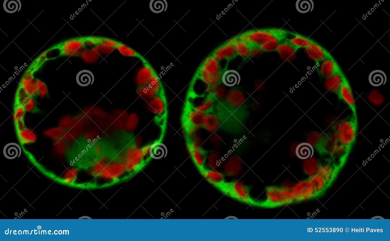 Arabidopsis protoplasts stock footage. Video of cytoplasm - 52553890