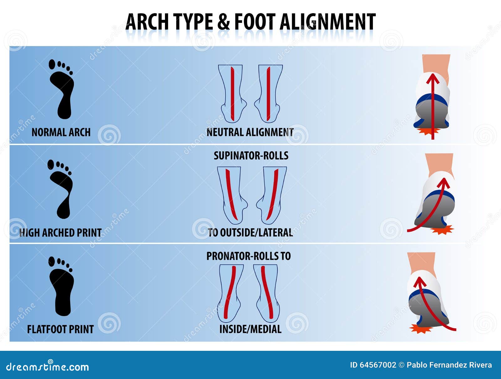 Arch Type and Foot Alignment Stock Vector - Illustration of symbol ... Arch Type and Foot Alignment Stock Vector - Illustration of symbol ...