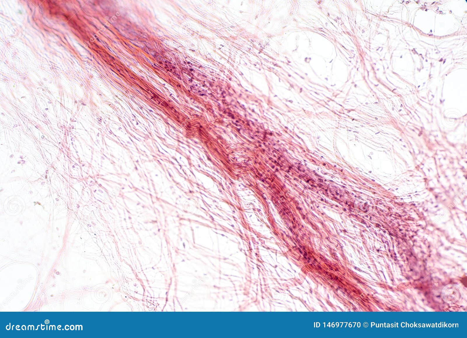 Areolar Connective Tissue Under the Microscope View Stock Illustration ...