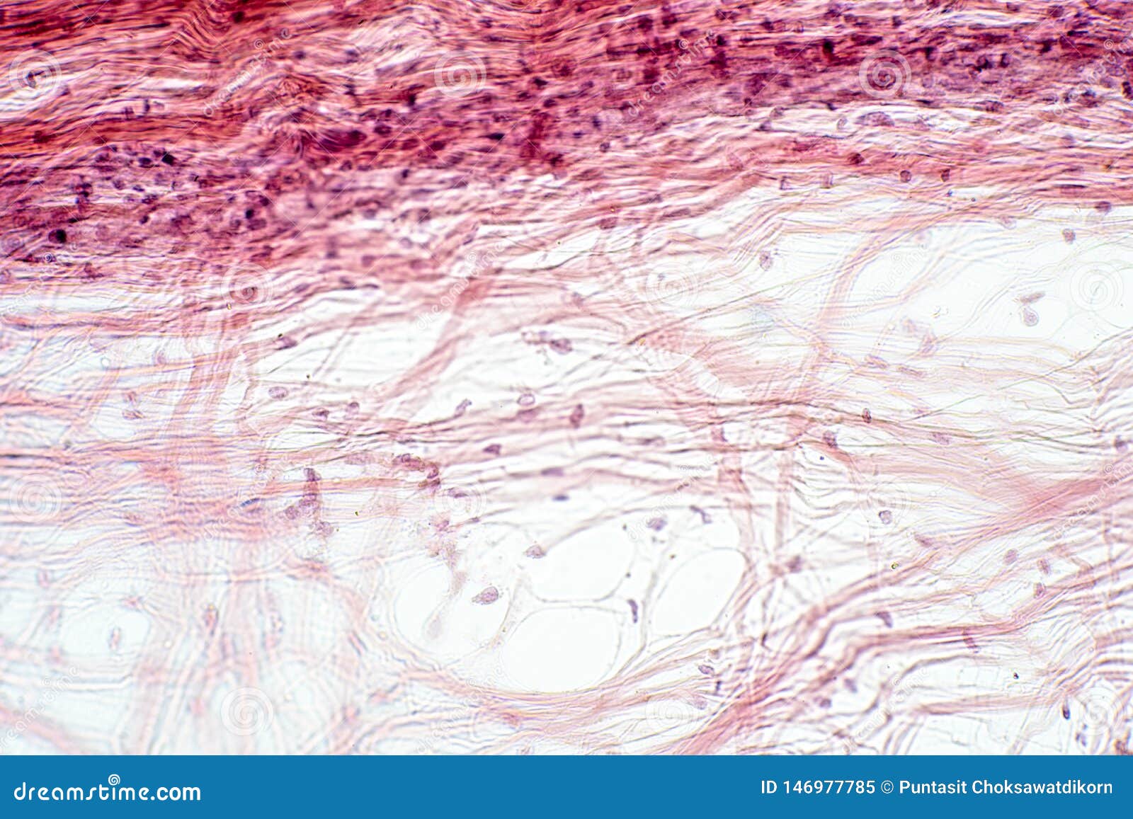 Areolar Connective Tissue Under the Microscope View Stock Illustration ...