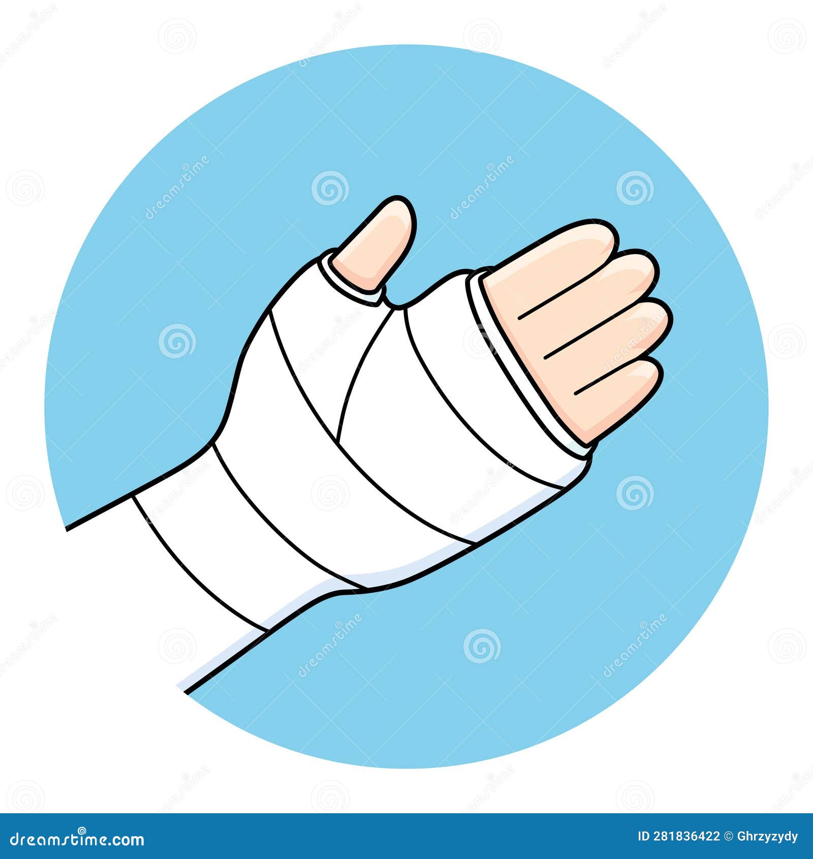 Broken Arm with Orthopedic Cast Stock Vector - Illustration of cast ...