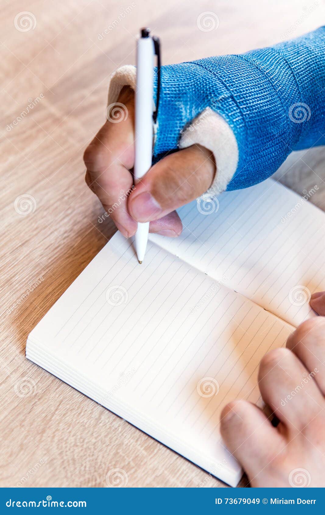 Arm with Blue Cast and Notepad Stock Image - Image of care, thumb: 73679049