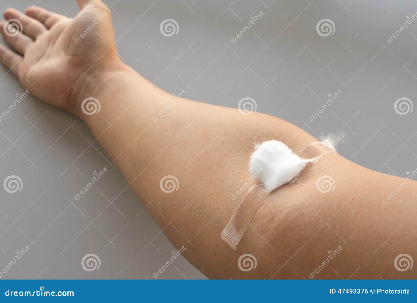 Arm covered plaster stock illustration. Illustration of sick - 47493376