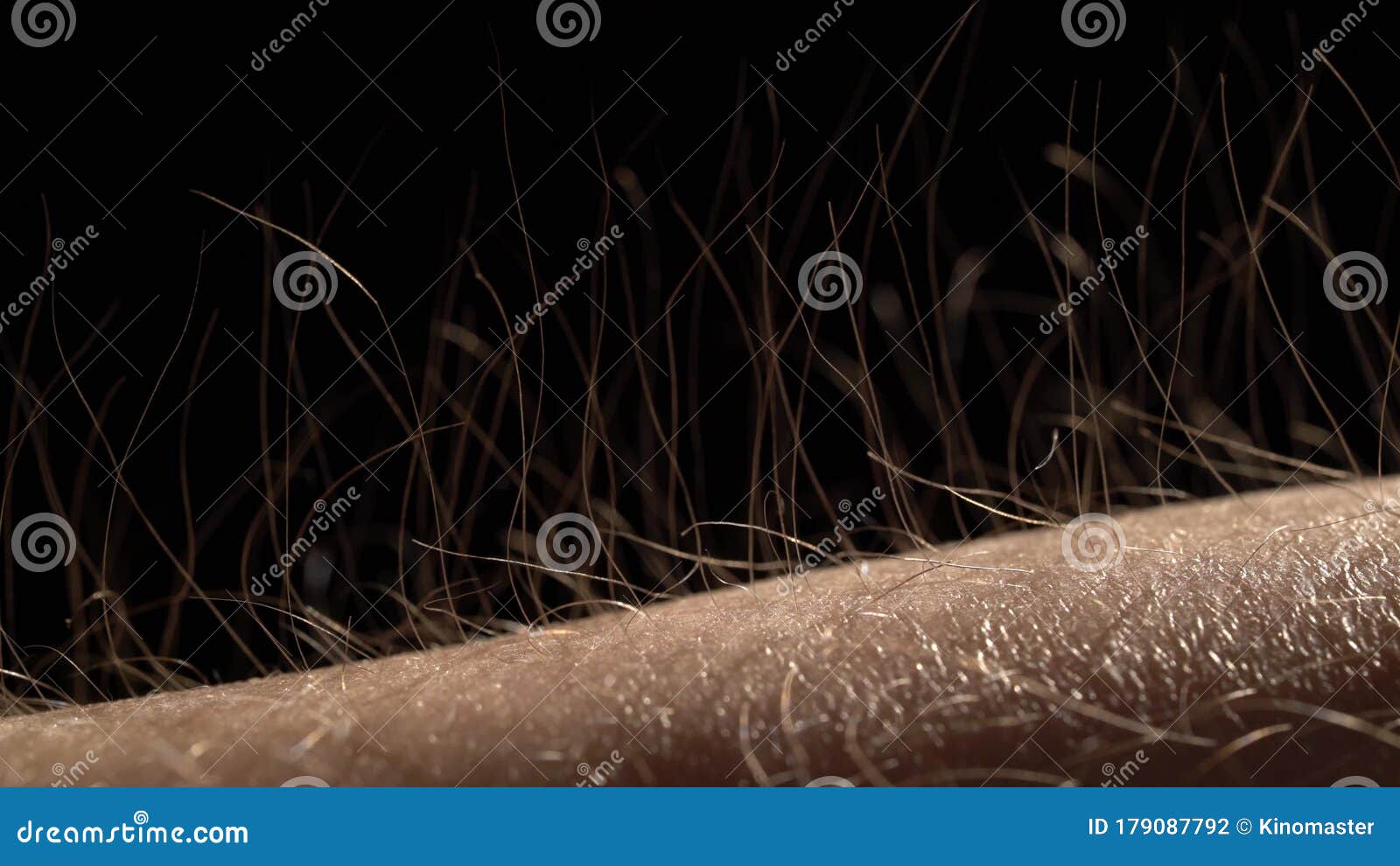 Arm Hair Rising, Emotional Feeling Stock Footage - Video of natural ...