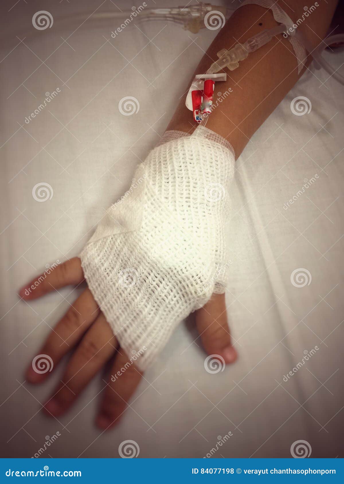 Arm of kid stock photo. Image of infusion, life, child - 84077198