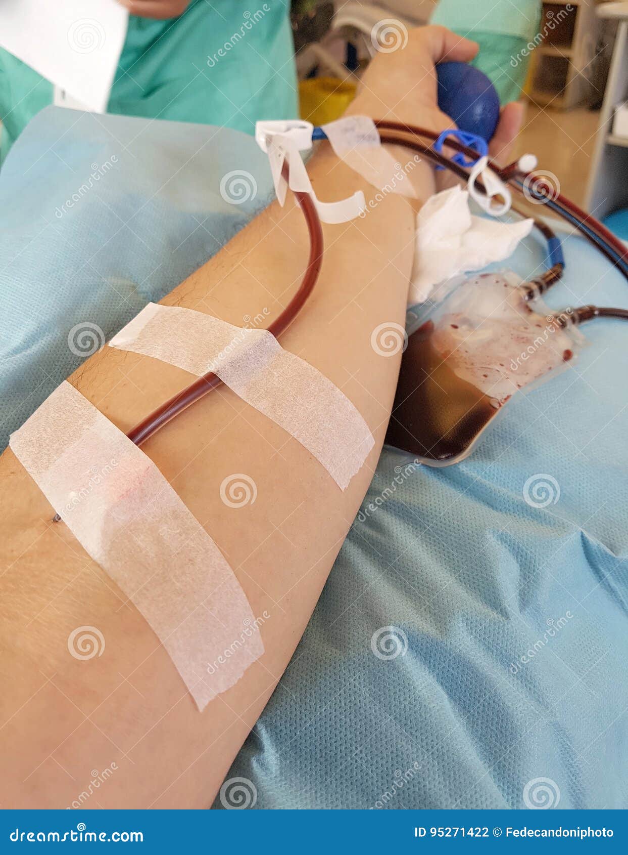 Arm of a Man while Donating Blood Stock Photo - Image of inpatient ...