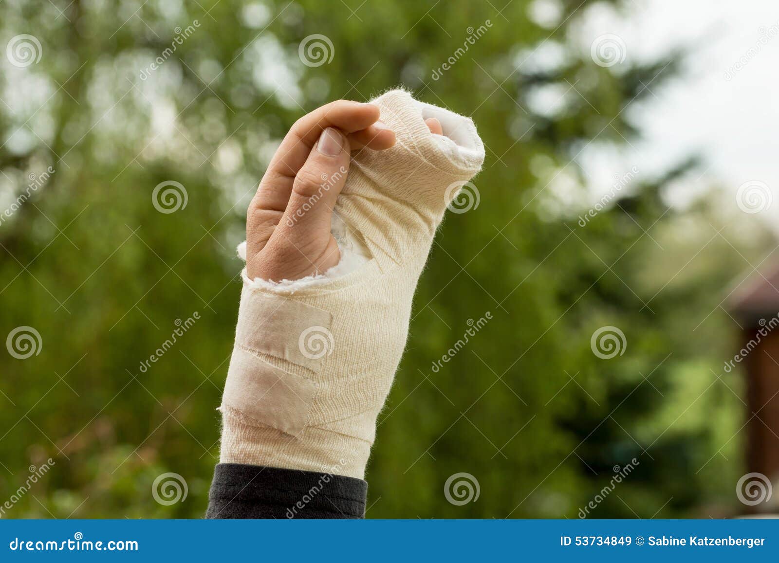 Arm in plaster stock image. Image of cast, body, broken - 53734849