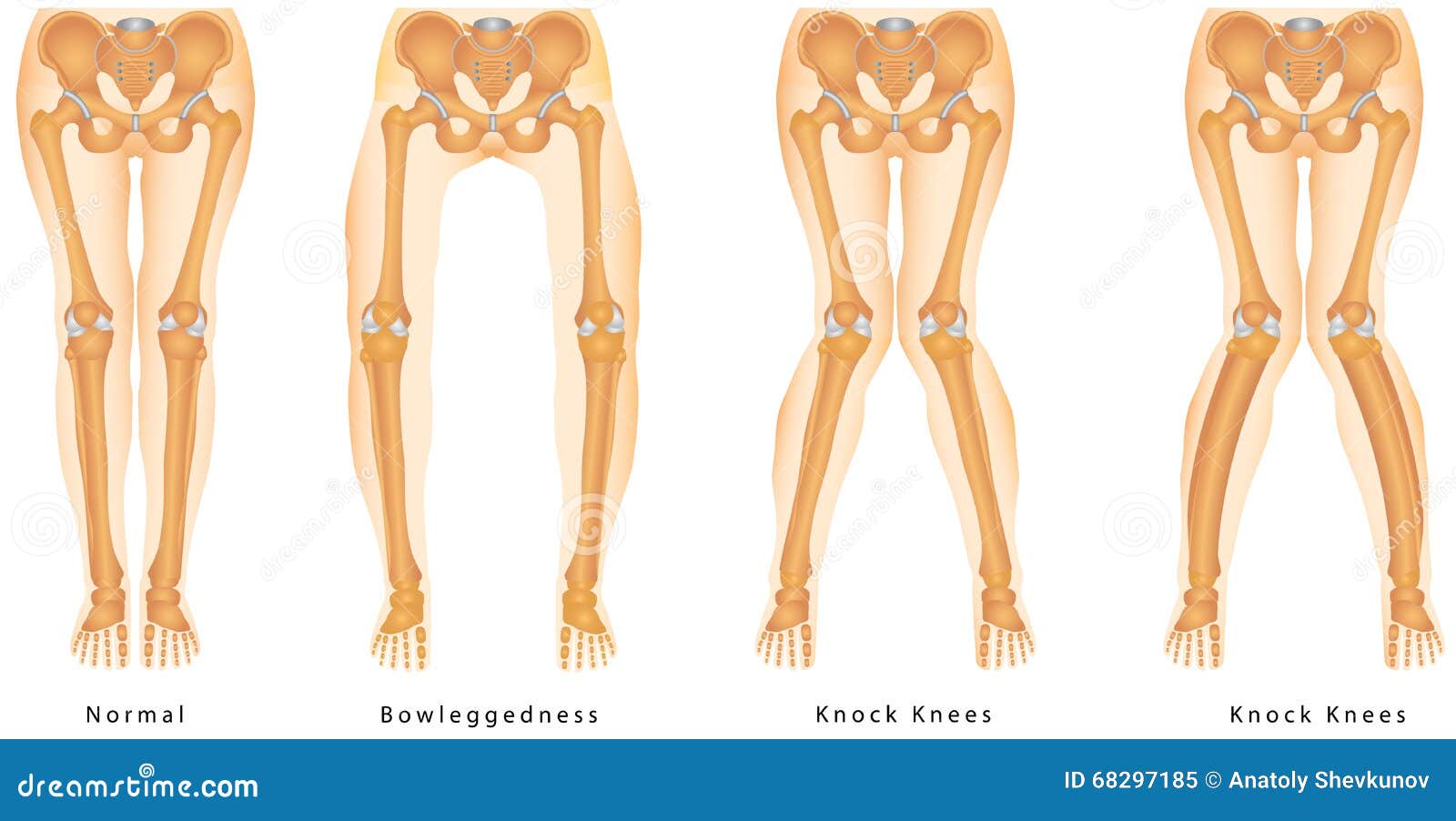 Arqué-jambes Illustration de Vecteur - Image: 68297185