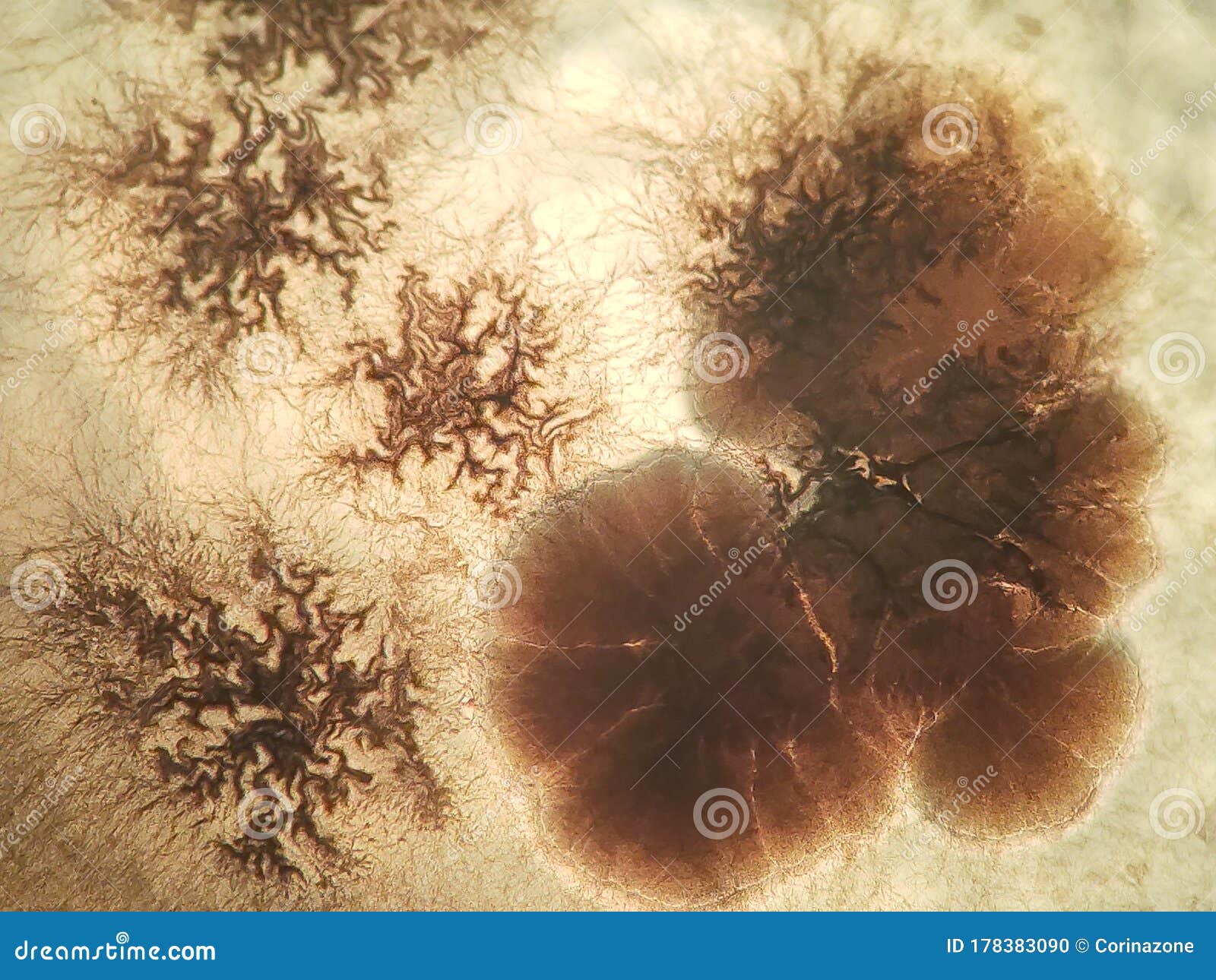 The Art of Bacteria Microscope View of Bacillus and Other Bacteria ...