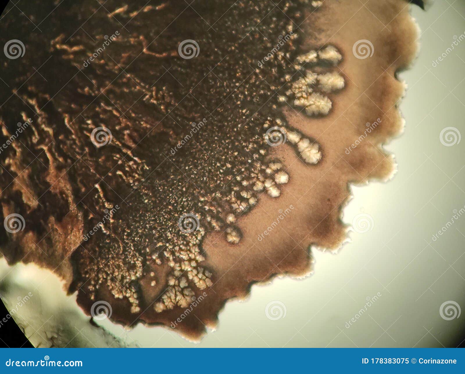 The Art of Bacteria Microscope View of Bacillus and Other Bacteria ...