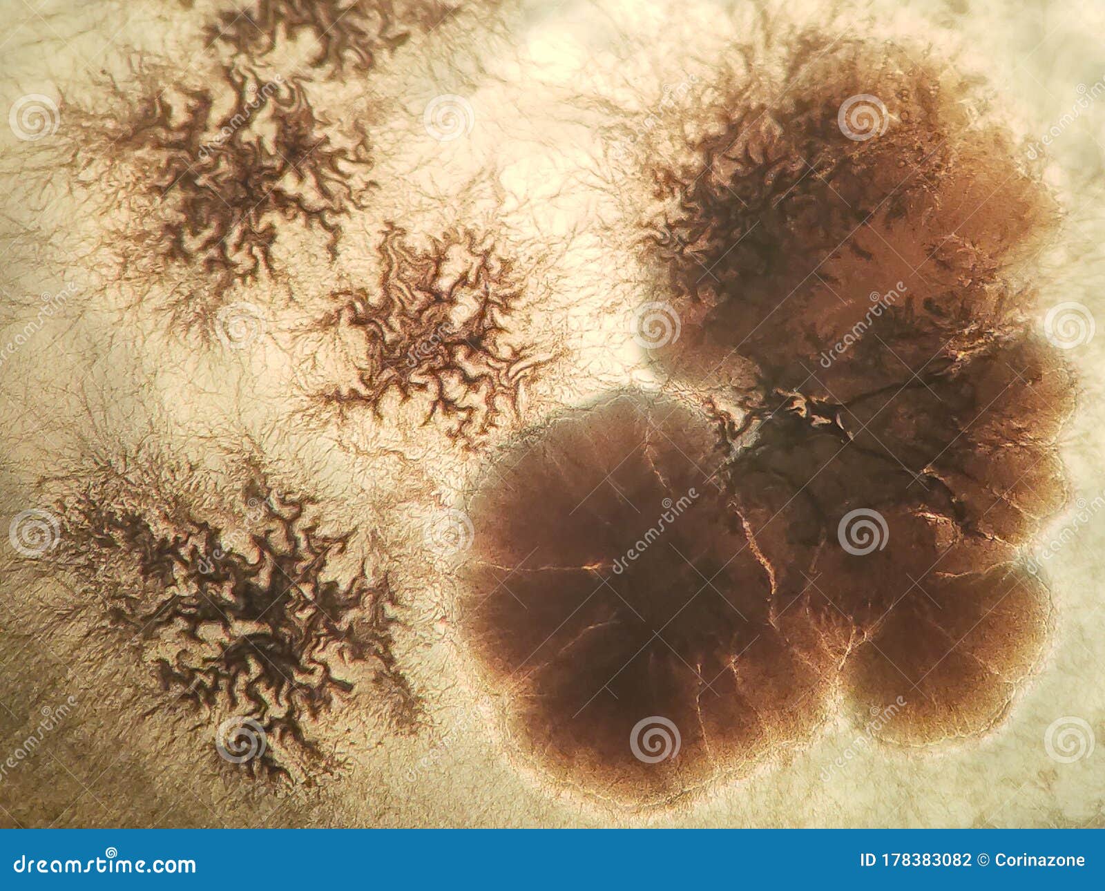 The Art of Bacteria Microscope View of Bacillus and Other Bacteria ...
